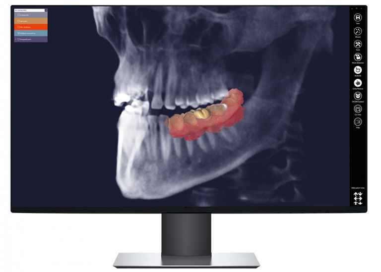 HOW DICOM BECAME THE STANDARD IN MEDICAL IMAGING TECHNOLOGY - Mystic ...